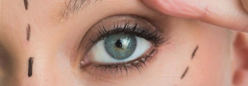 Augenlid-Operation | Medical Eye-Care
